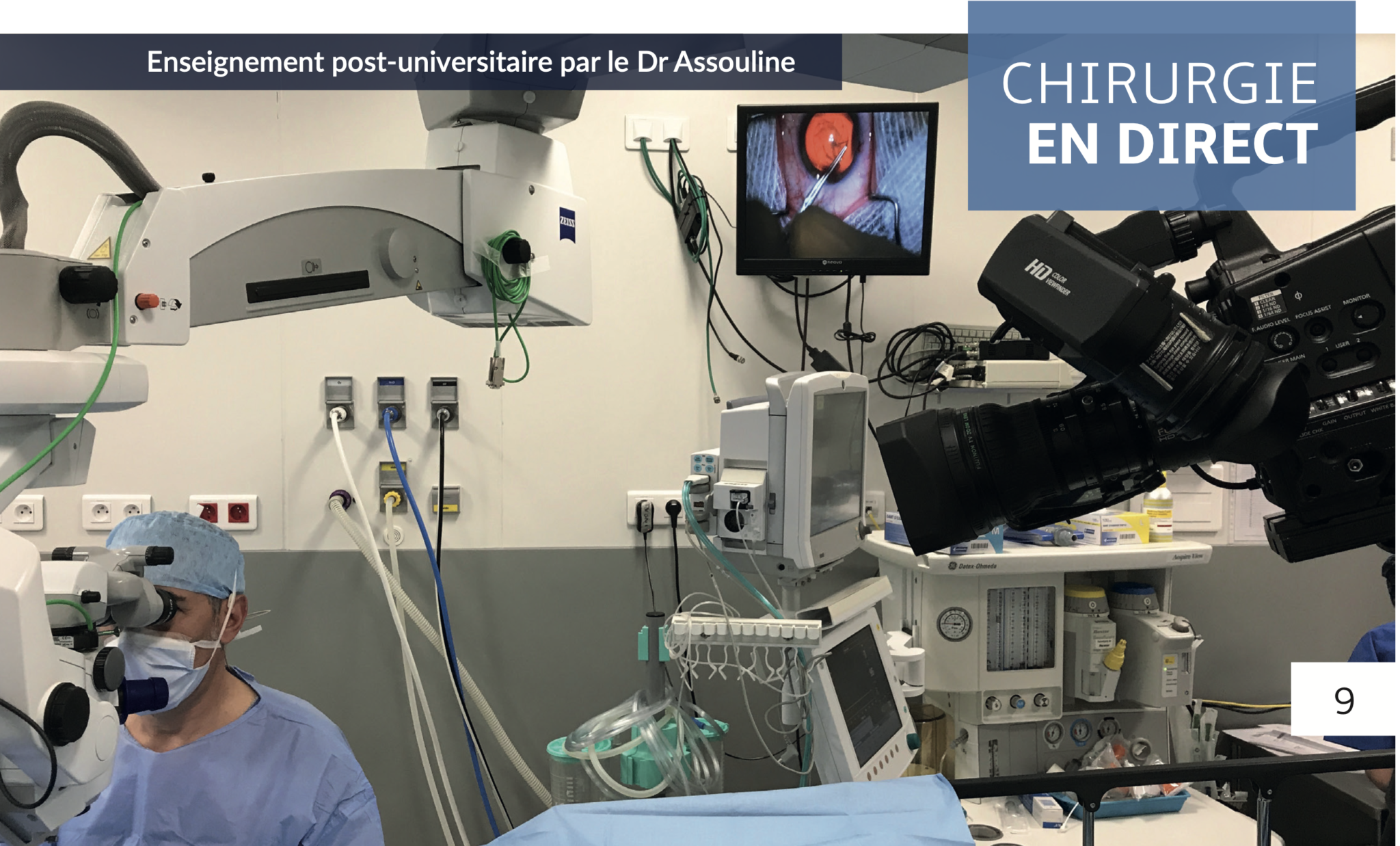 Déroulement de la chirurgie de la cataracte ophtalmologie Paris